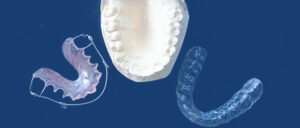 Invisalign Buttons: A Comprehensive Guide (What You Need to Know)Â